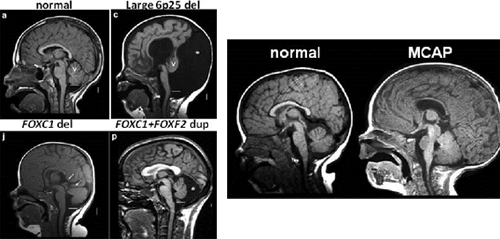 The Limbic System “Lizard brain” – SWC Healthcare