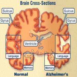 The Limbic System “Lizard brain” – SWC Healthcare
