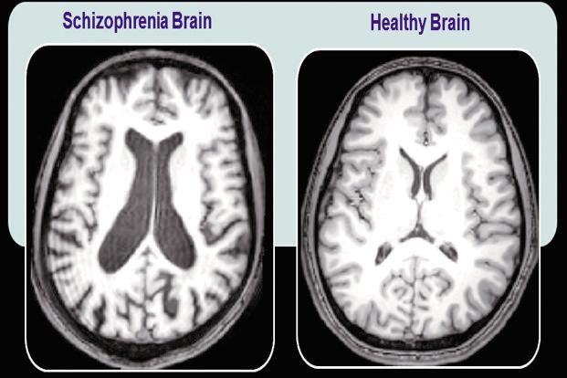 The Limbic System “Lizard brain” – SWC Healthcare